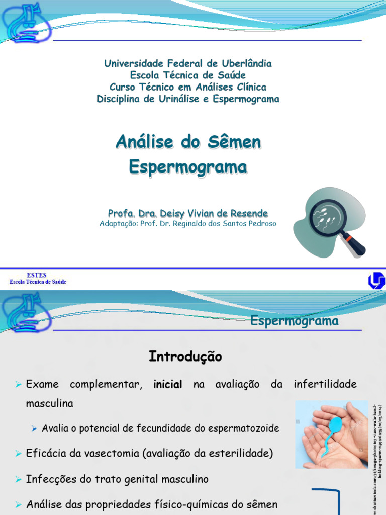 7-Espermograma | PDF | Sêmen | Ejaculação