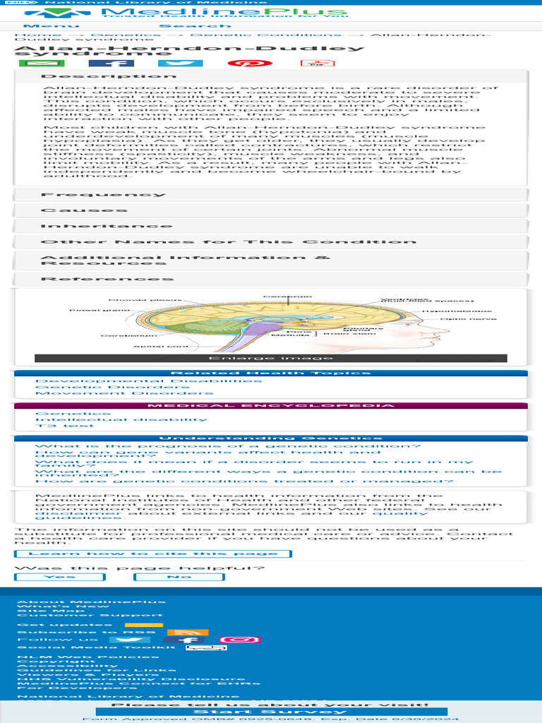 Allan-Herndon-Dudley Syndrome MedlinePlus Geneti | PDF | Diseases And Disorders | Neurological ...