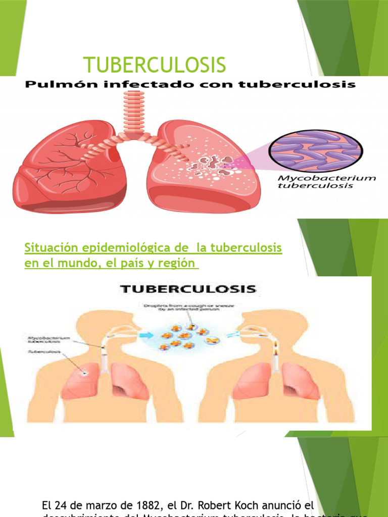Epidemiología y tratamiento de la tuberculosis | PDF | Tuberculosis ...