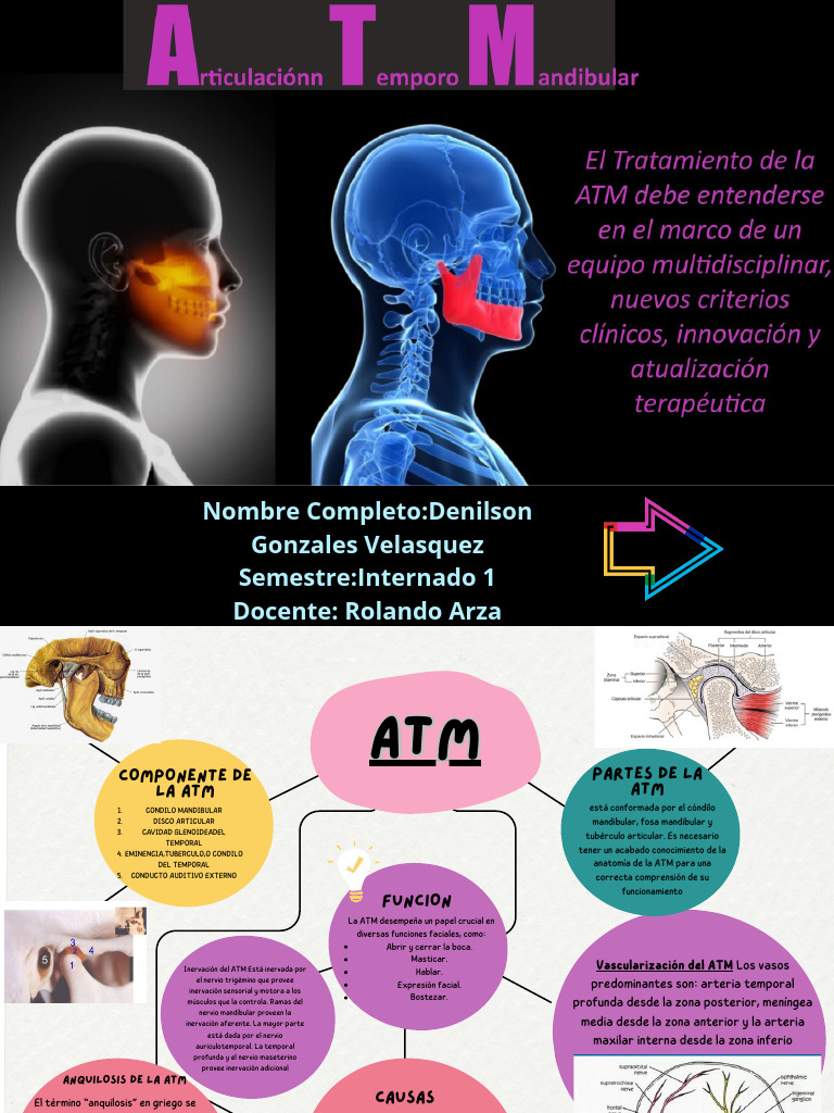 Todo Sobre Atm | PDF | Articulación | Osteoartritis