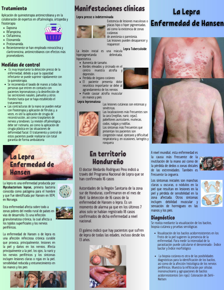 Tipos y tratamiento de la lepra | PDF | Lepra | Enfermedades y trastornos