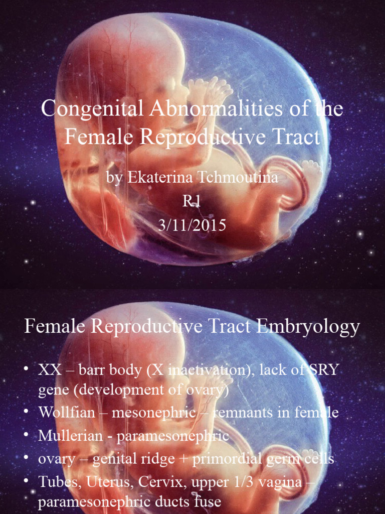 Congenital Abnormalities of The Female Reproductive Tract: by Ekaterina ...