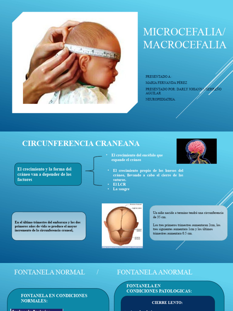 MICROCEFALIA | PDF | Cráneo | Medicina