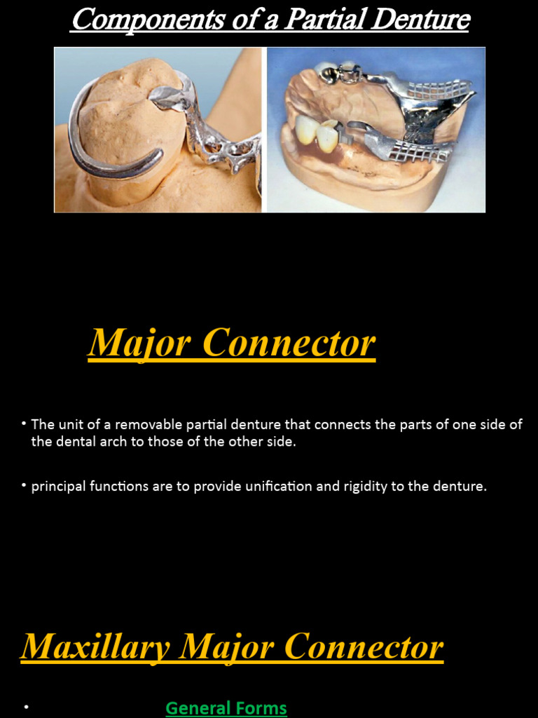 Connectors | PDF | Dentures | Dental Anatomy