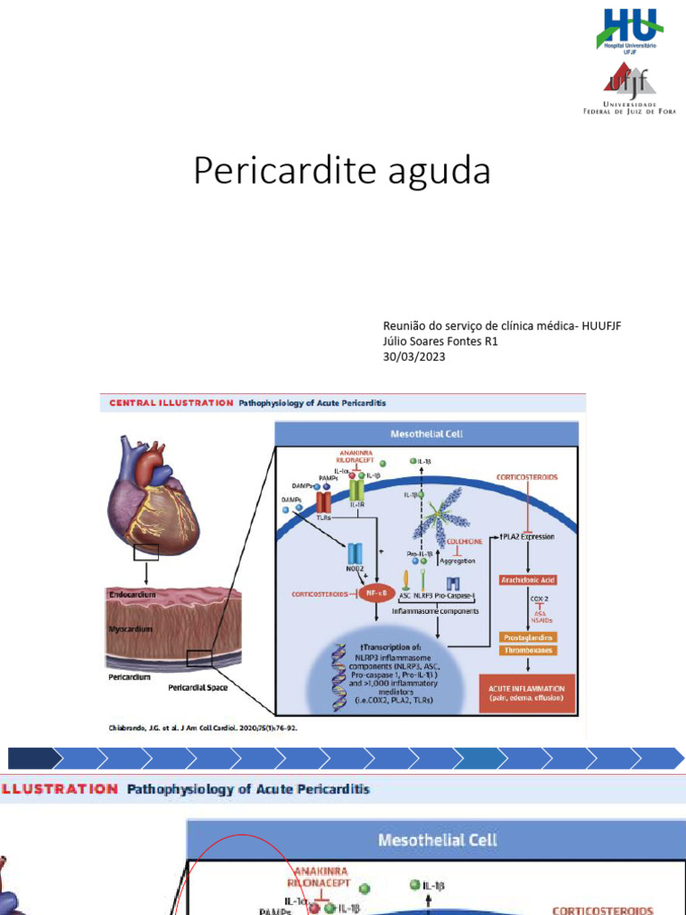 Pericardite Aguda 23 29 | PDF | Medicina Clínica | Doenças e distúrbios