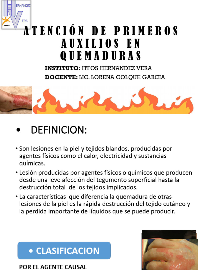 Quemaduras | Descargar gratis PDF | Quemar | Primeros auxilios