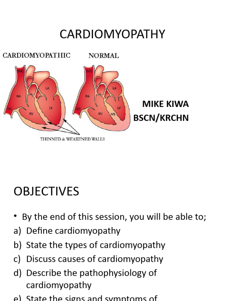 CARDIOMYOPATHY | PDF | Cardiac Muscle | Heart