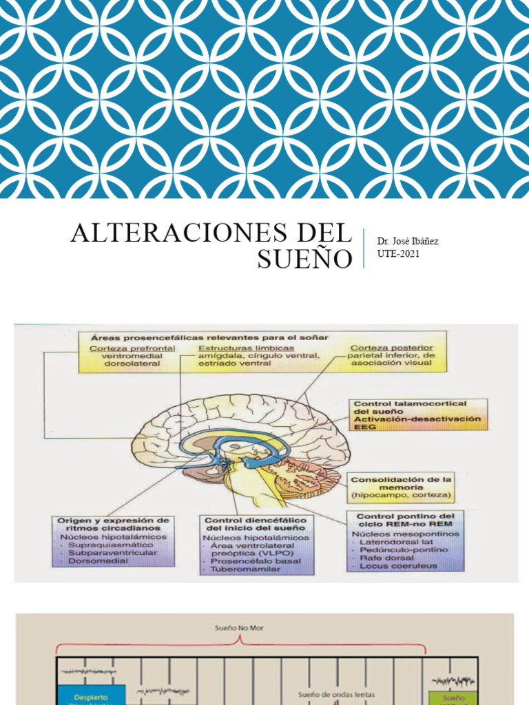 Alteraciones Del Sueño | PDF | Insomnio | Dormir