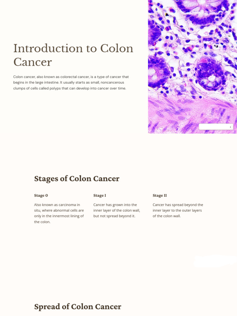 Updated Colon Cancer | PDF | Colorectal Cancer | Cancer