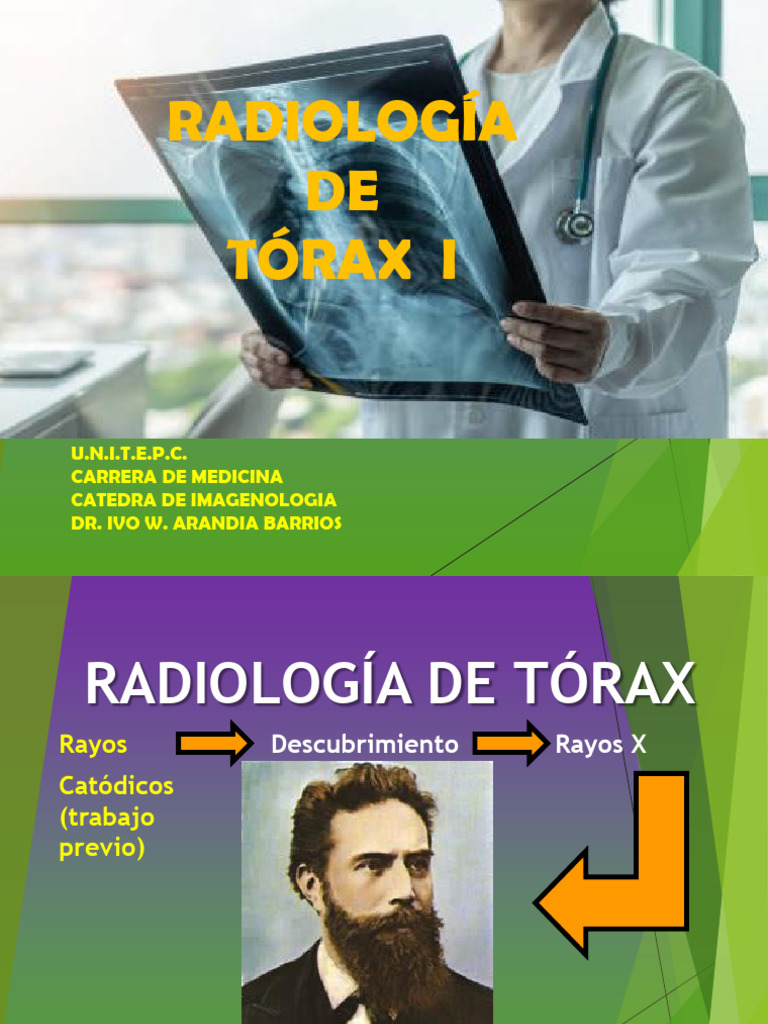 RX Torax I | Descargar gratis PDF | Aorta | Pulmón