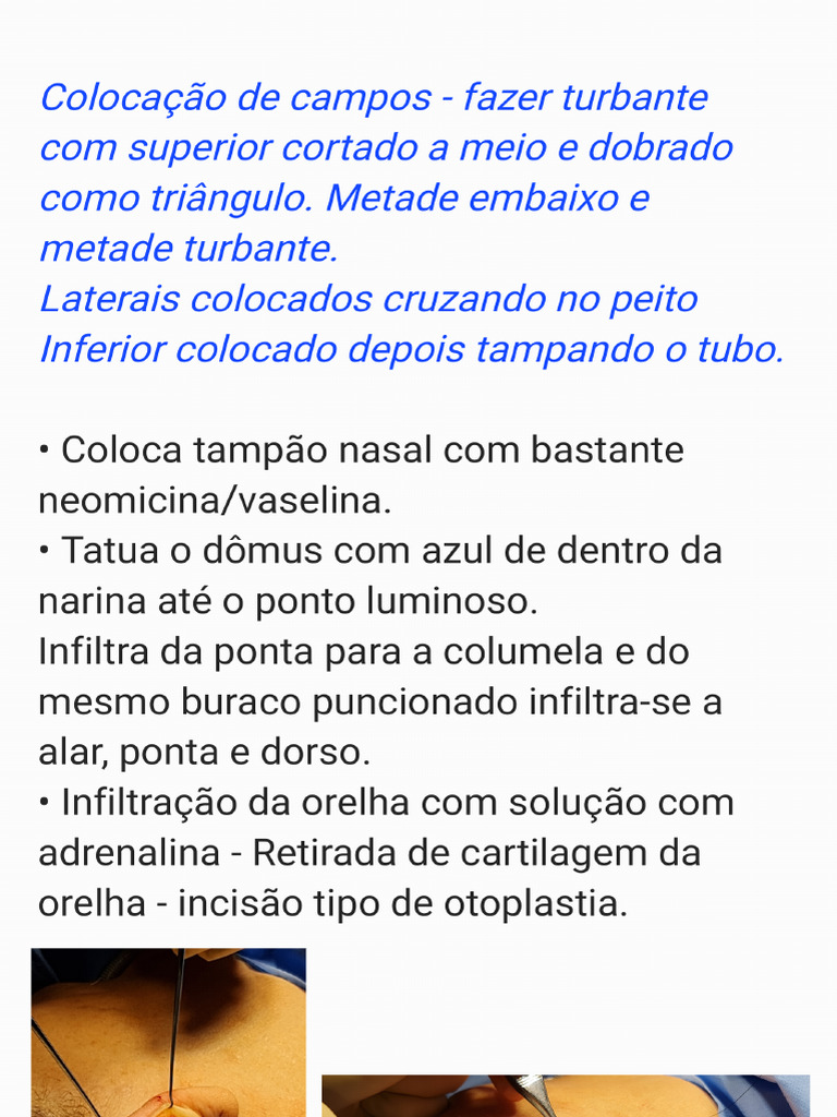 Rinoplastia Básico Pdf