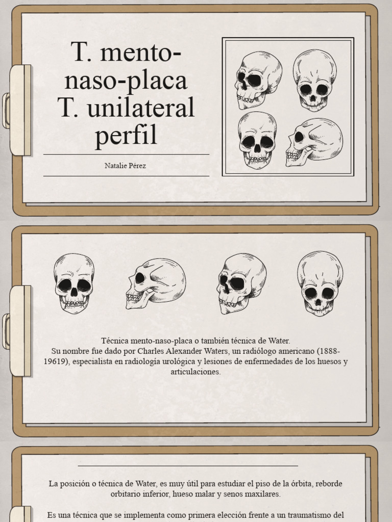 Técnica Mento-Naso-Placa | PDF | Cabeza y cuello humanos | Anatomía humana