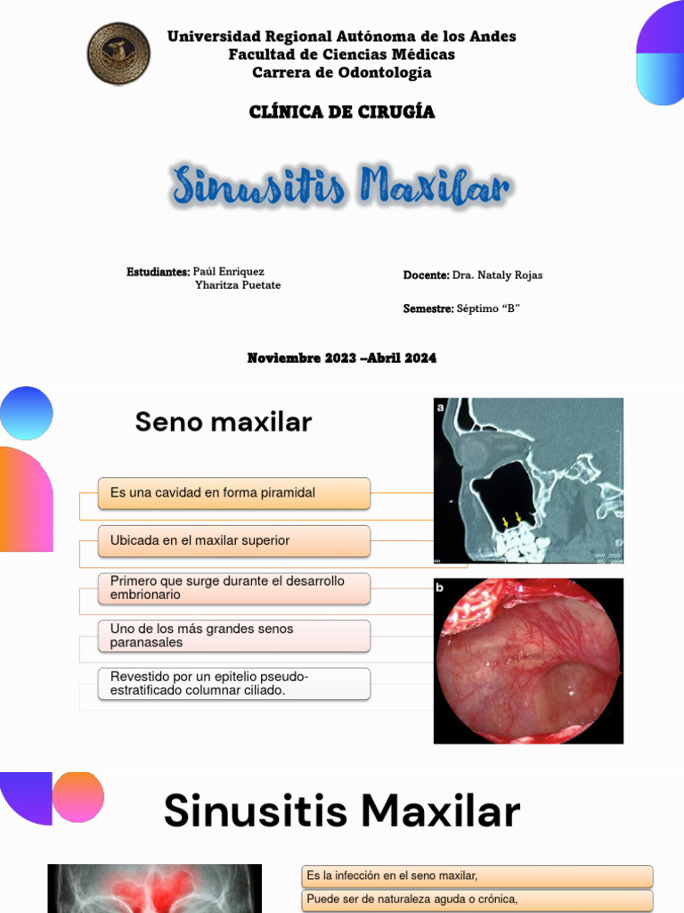 Sinusitis Maxilar: Causas y Tratamiento | PDF | Especialidades Medicas | Medicina CLINICA
