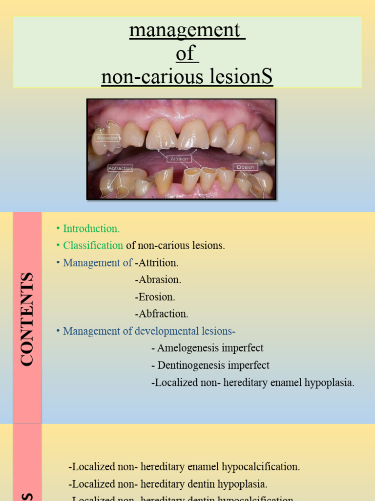 Management of Non-Carious Lesions | PDF | Tooth Enamel | Human Tooth