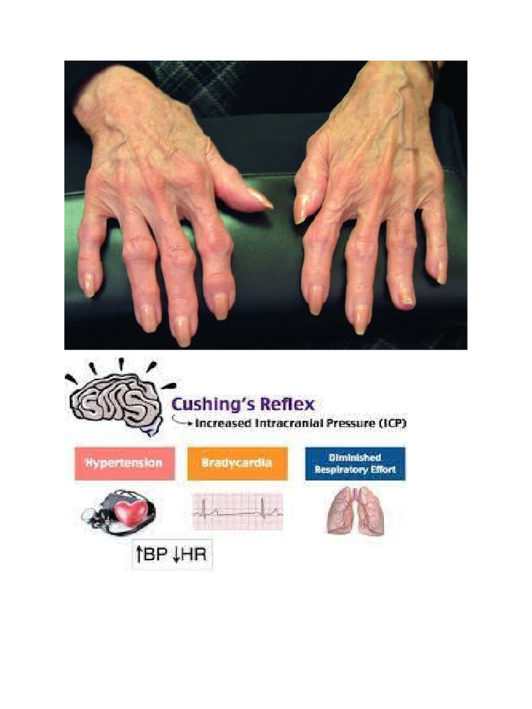 Catet Catet | PDF