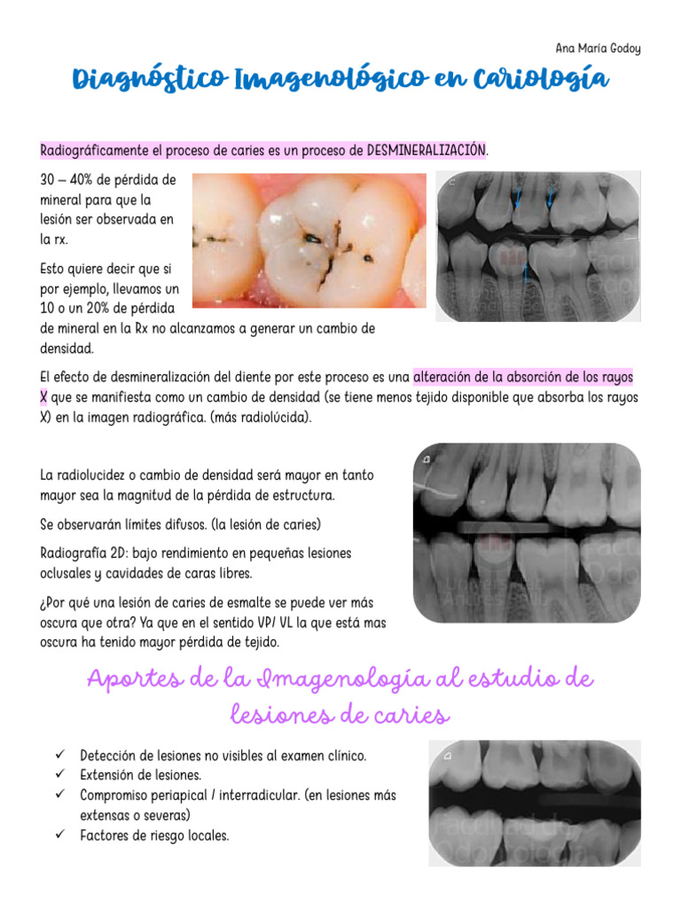 Diagnóstico Radiológico de Caries | PDF | Imagenes medicas | Esmalte de ...