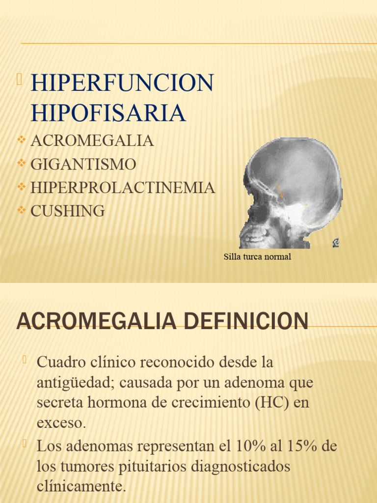 ACROMEGALIA | PDF | Hormona de crecimiento | Especialidades Medicas
