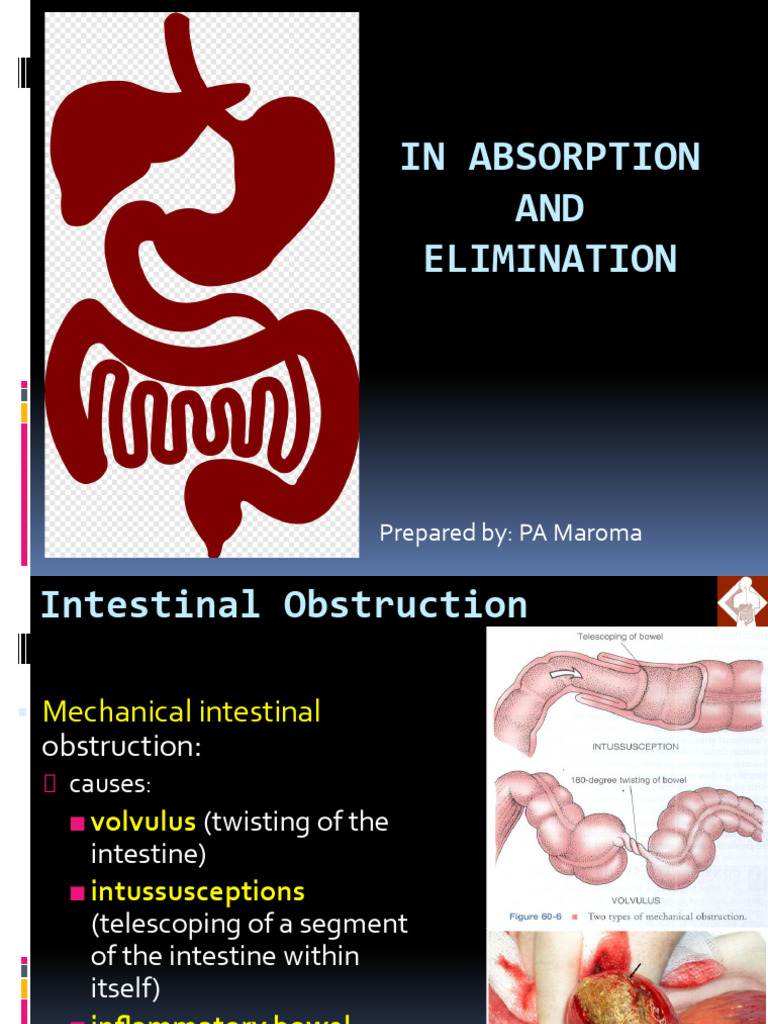 Week2 Lgit | PDF | Hemorrhoid | Crohn's Disease
