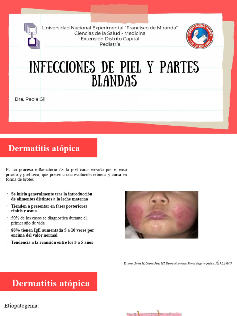 Dermatitis atópica y seborreica en pediatría | PDF | Psoriasis | Piel