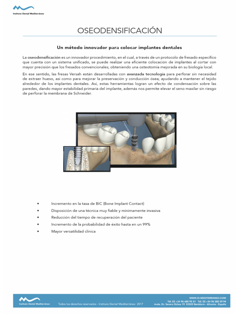 Oseodensificación con fresas Versah | PDF