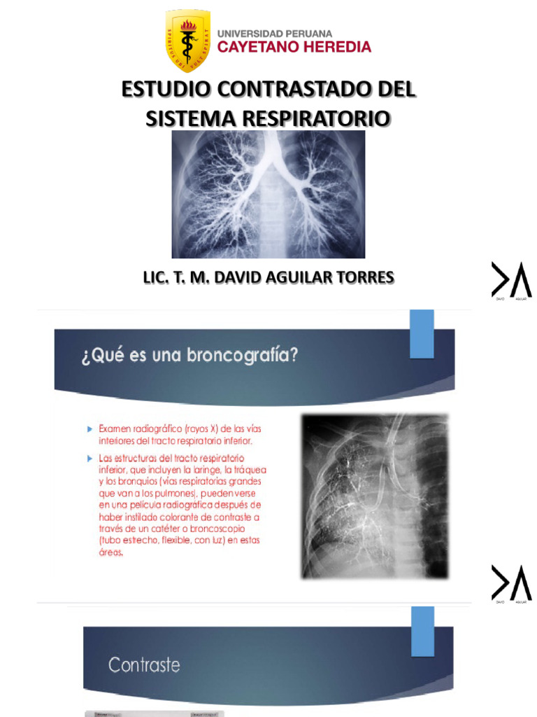 Estudio Contrastado Del Sistema Respiratorio 2022 | PDF
