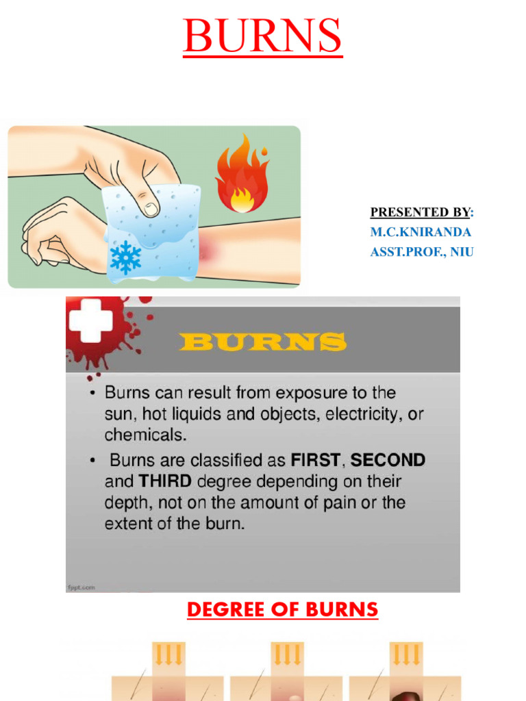 BURNS | PDF