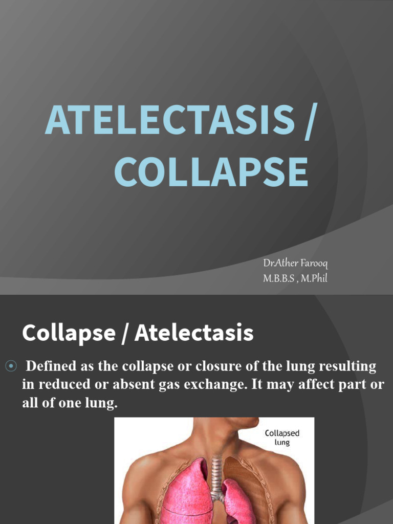 Atelectasis Lecture Final | PDF | Lung | Respiratory System