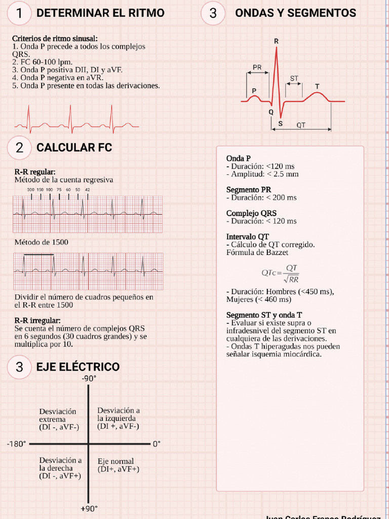 Ekg 2 | PDF | Electrocardiografia | Teoría de la medicina
