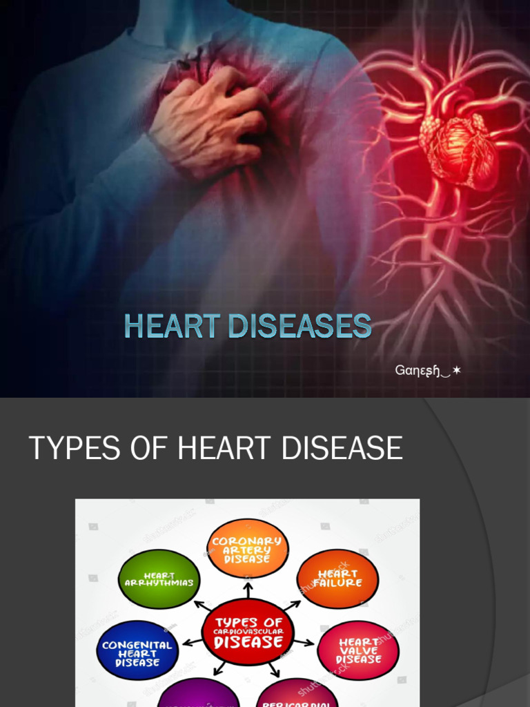 Heart Diseases - by Ganesh | PDF | Coronary Artery Disease | Heart