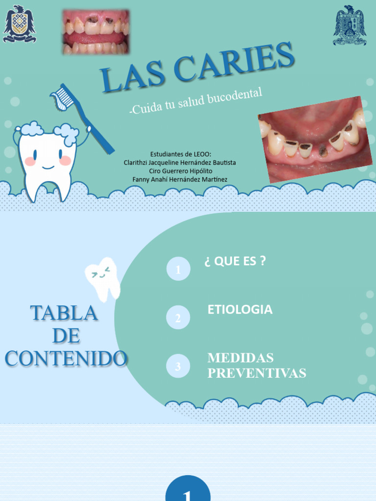 las caries | PDF | Medicina CLINICA | Boca
