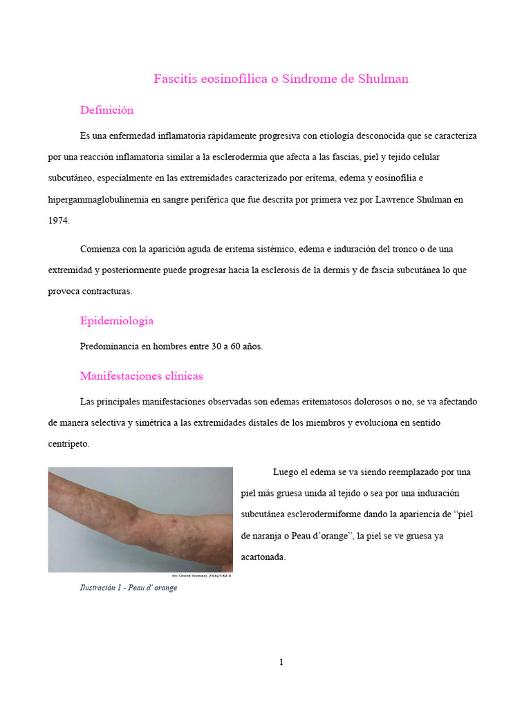 Fascitis eosinofílica o Síndrome de Shulman | PDF | Inflamación | Medicina
