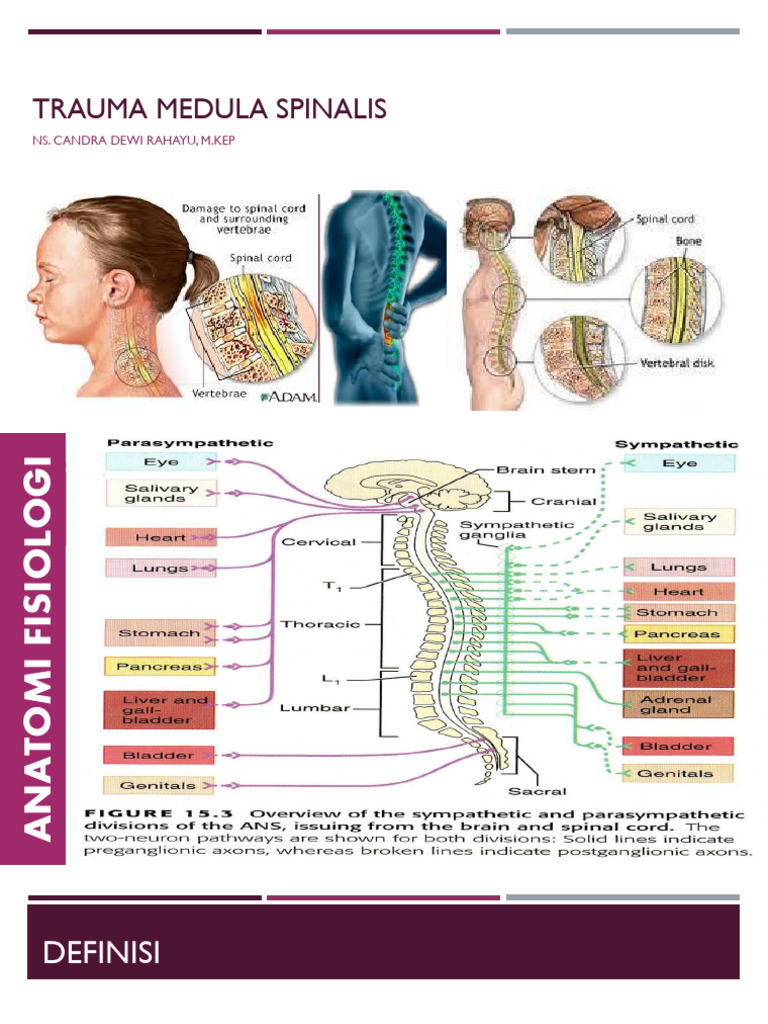 Trauma Medula Spinalis | PDF