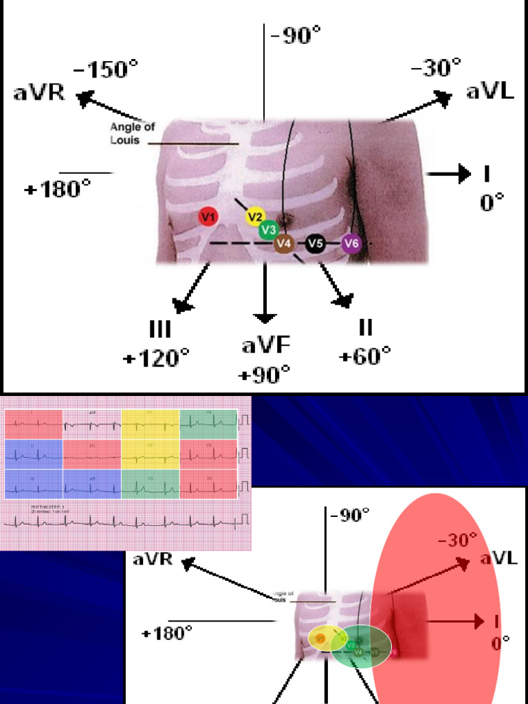 Als Ecg Pdf