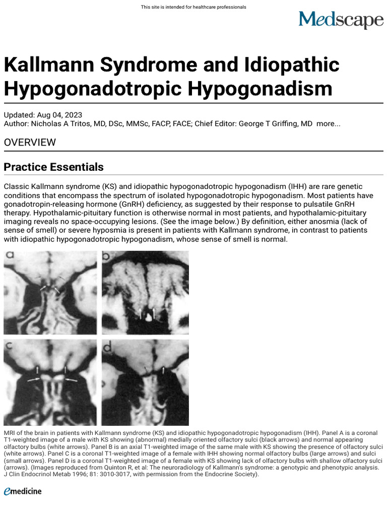 Kallmann Syndrome and Idiopathic Hypogonadotropic Hypogonadism | PDF | Luteinizing Hormone ...