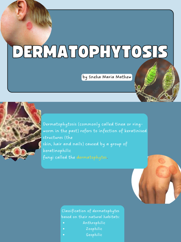 Dermatophytes 20240314 214707 0000 | Download Free PDF | Clinical ...