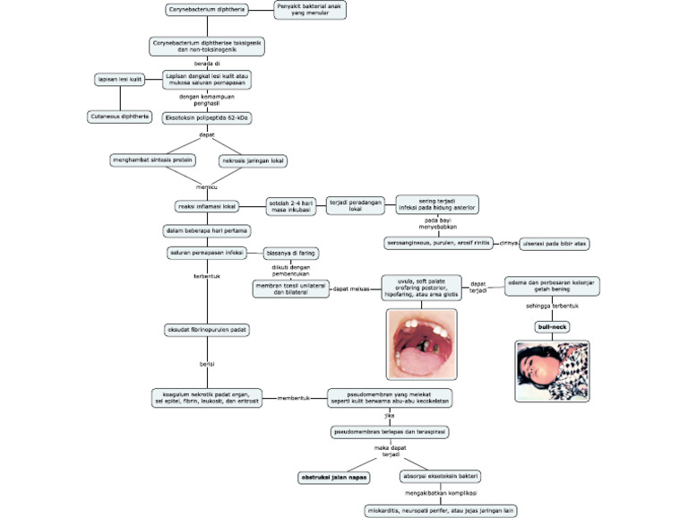 Patogenesis Dan Patofisiologi Difteri | PDF