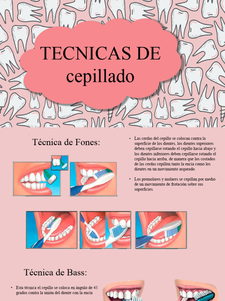 Tecnicas de Cepillado | Descargar gratis PDF | Diente | Ramas de ...