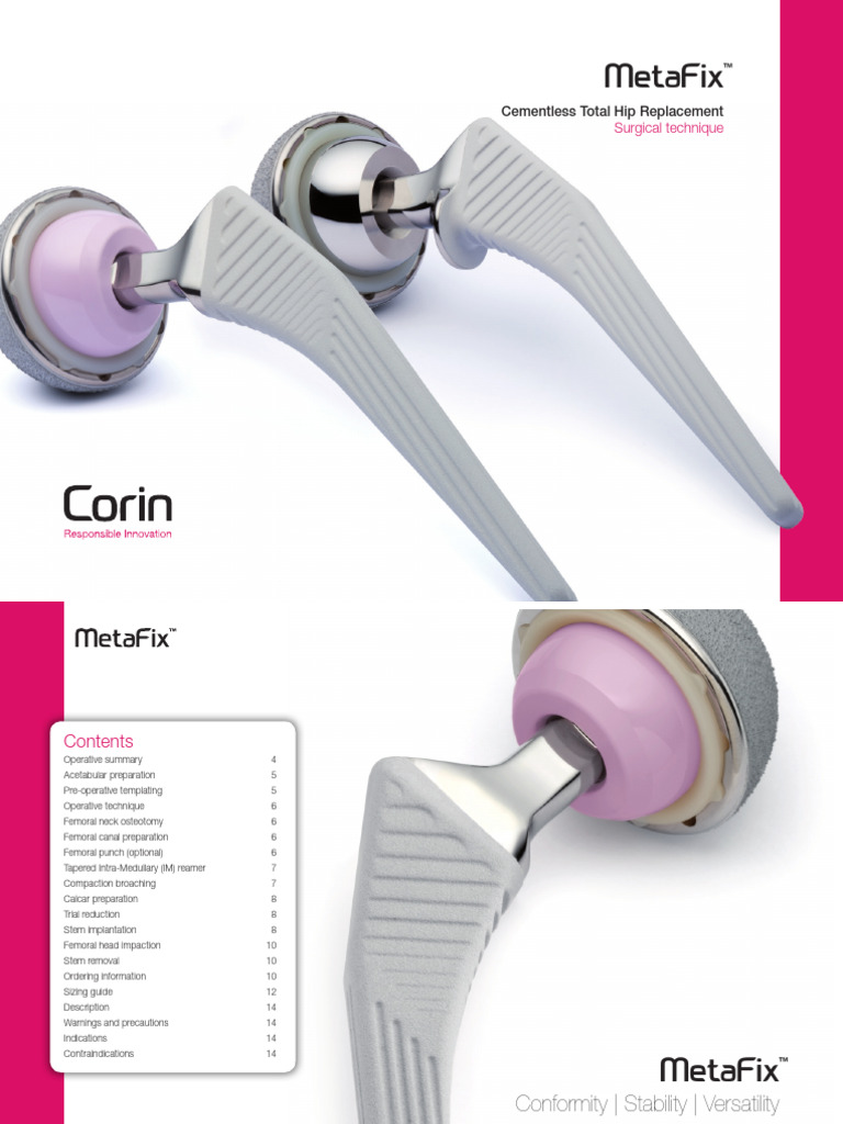 METAFIX NUEVO MEDIDAS | PDF | Hip | Musculoskeletal System