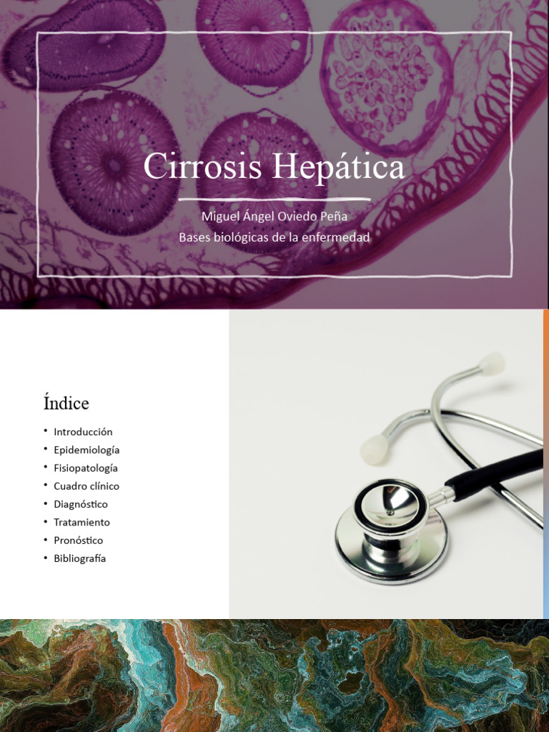 Cirrosis Hepática | PDF | Hígado | Cirrosis