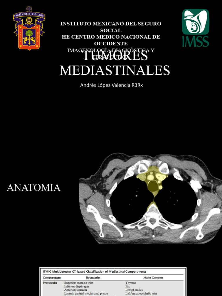 Tumores Del Mediastino Onco | PDF | Neoplasias | Medicina CLINICA
