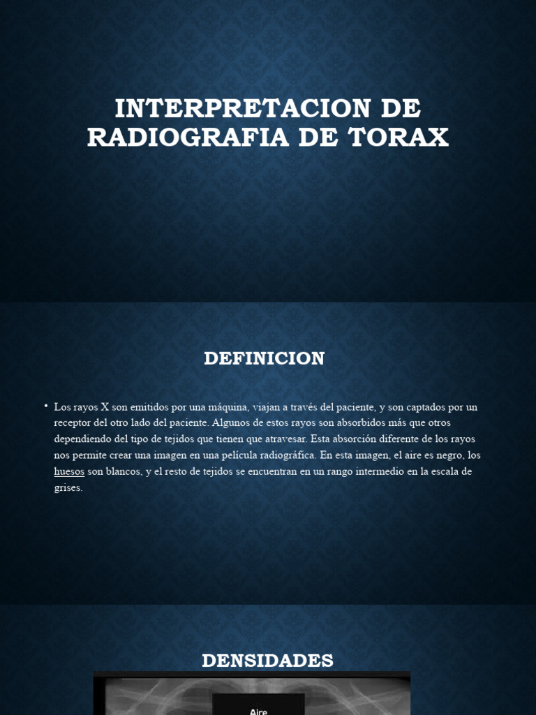 Interpretacion de Radiografia de Torax | PDF