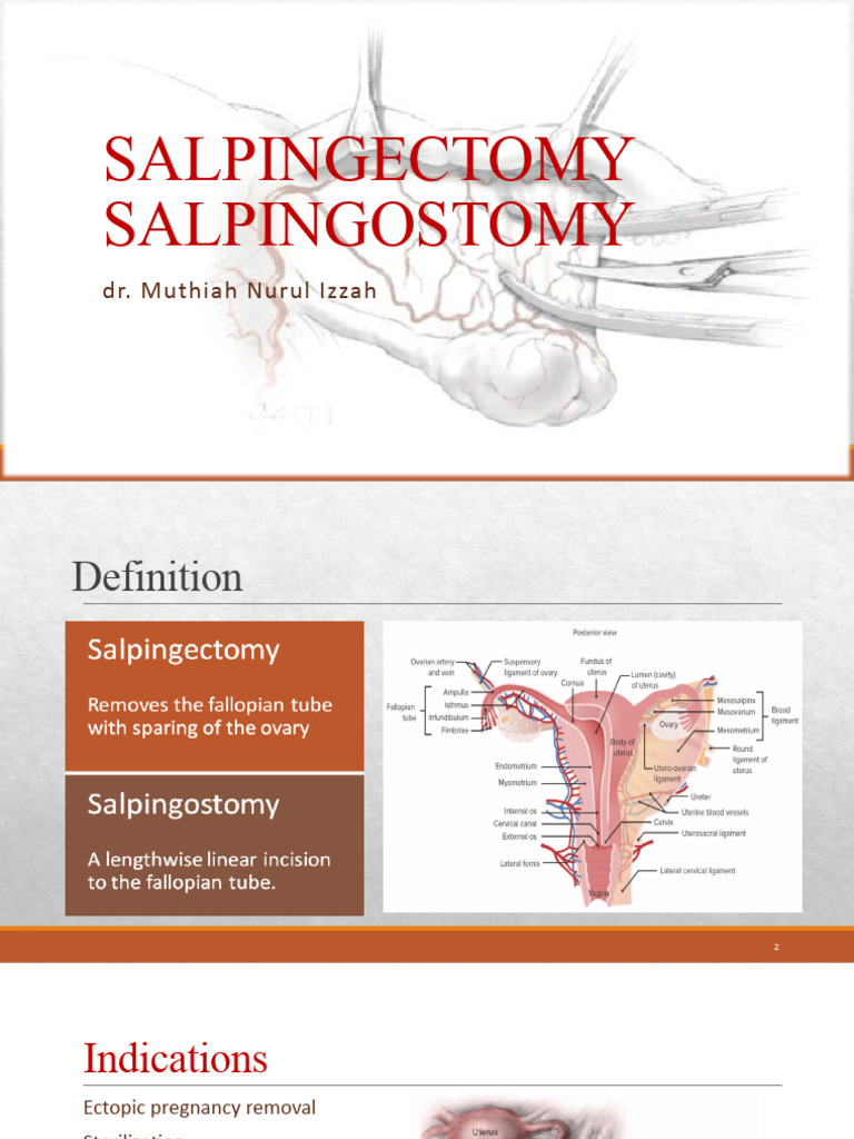 Salpingostomy vs. Salpingectomy Overview | PDF | Diseases And Disorders ...
