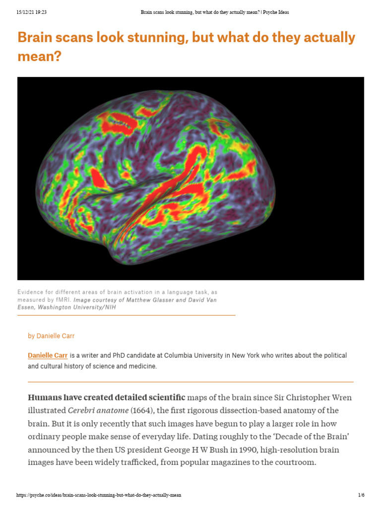 Brain Scans Look Stunning, But What Do They Actually Mean - Psyche ...