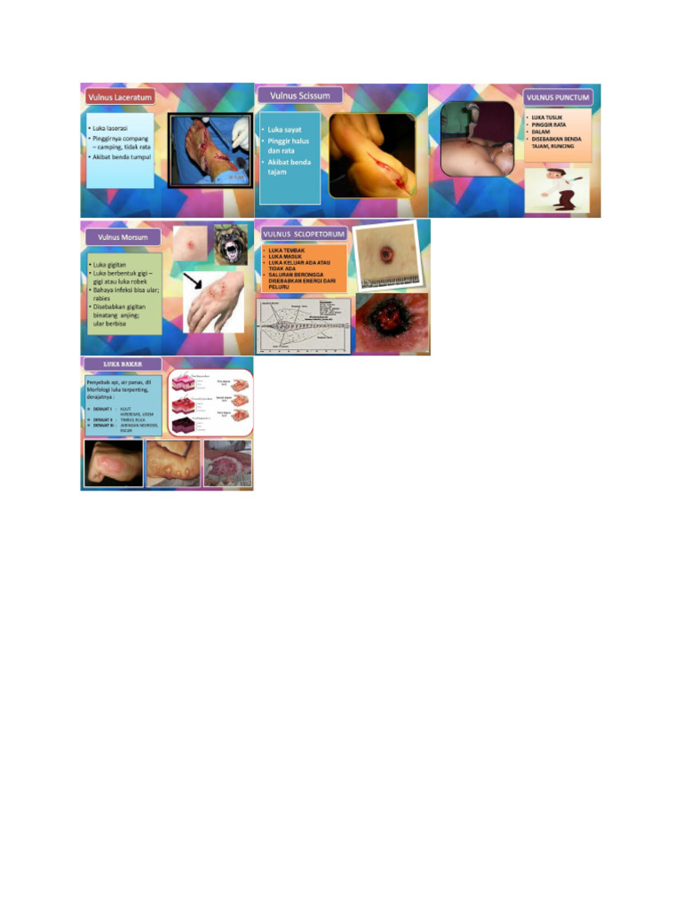 Poster UGD | PDF