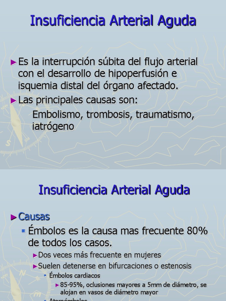 6 Insuficiencia Arterial Aguda Isquemia Trombo