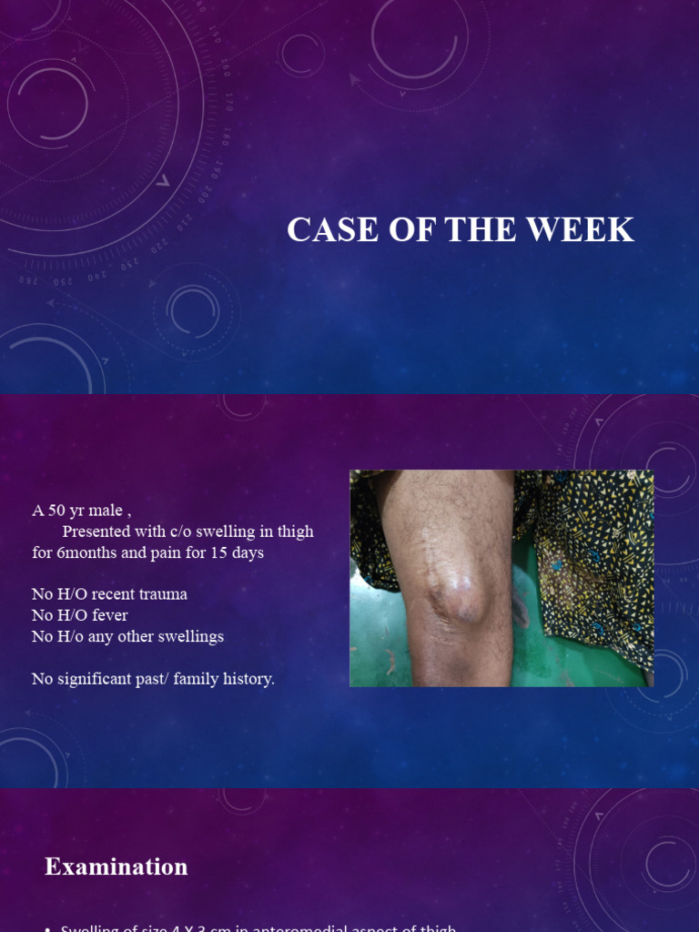 Case of The Week - Spindle Cell | PDF | Neoplasms | Magnetic Resonance ...