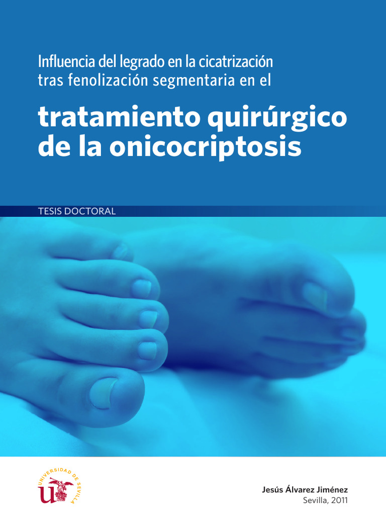 Tratamiento Quirúrgico de La Onicocriptosis | PDF | Dedo del pie ...