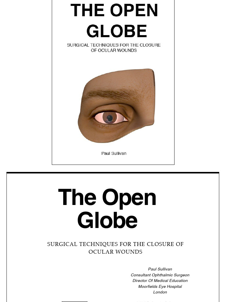The Open Globe Medium | PDF | Knot | Ophthalmology