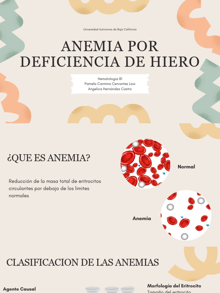 05 Anemia Por Deficiencia de Hierro | PDF | Glóbulo rojo | Anemia