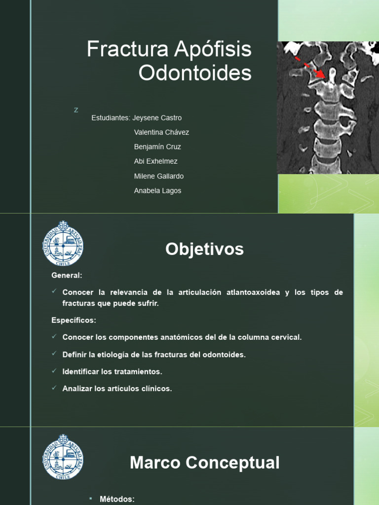 Fracturas de la Apófisis Odontoides | PDF | La columna vertebral | Vértebra